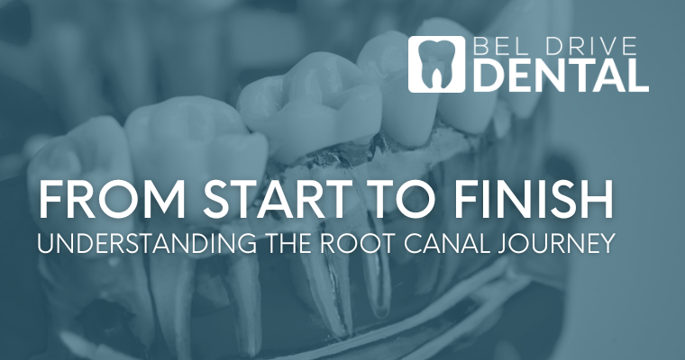What to Expect During a Root Canal Procedure